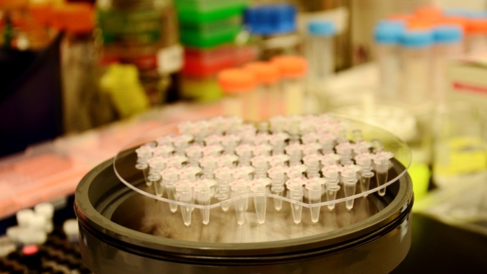 Blood test on the scent of prions - European Biotechnology Magazine