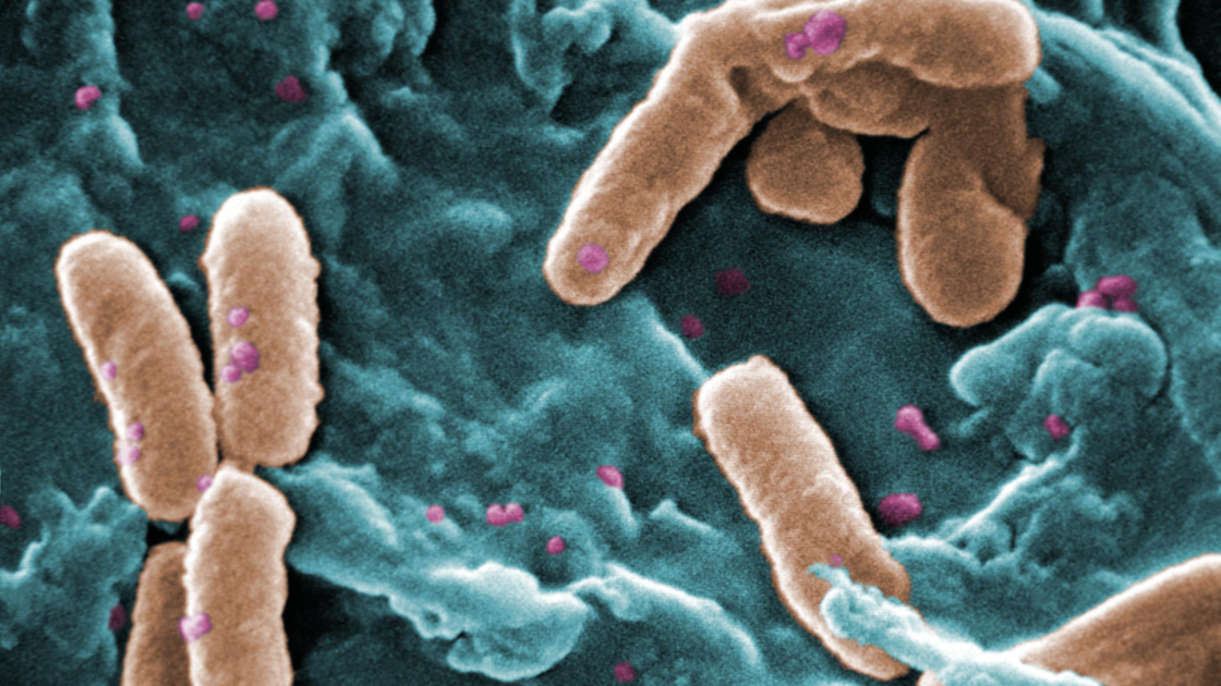 €7.6m by CARB-X dangling for Antabio - European Biotechnology Magazine