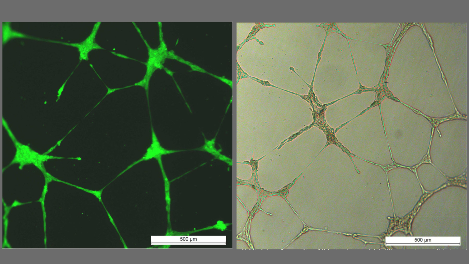 Angiogenesis, Cell Migration & Invasion Assays - European Biotechnology ...