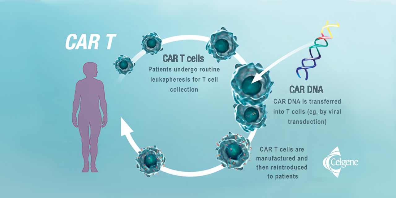 CAR-Ts: Novartis wins UK - European Biotechnology Magazine