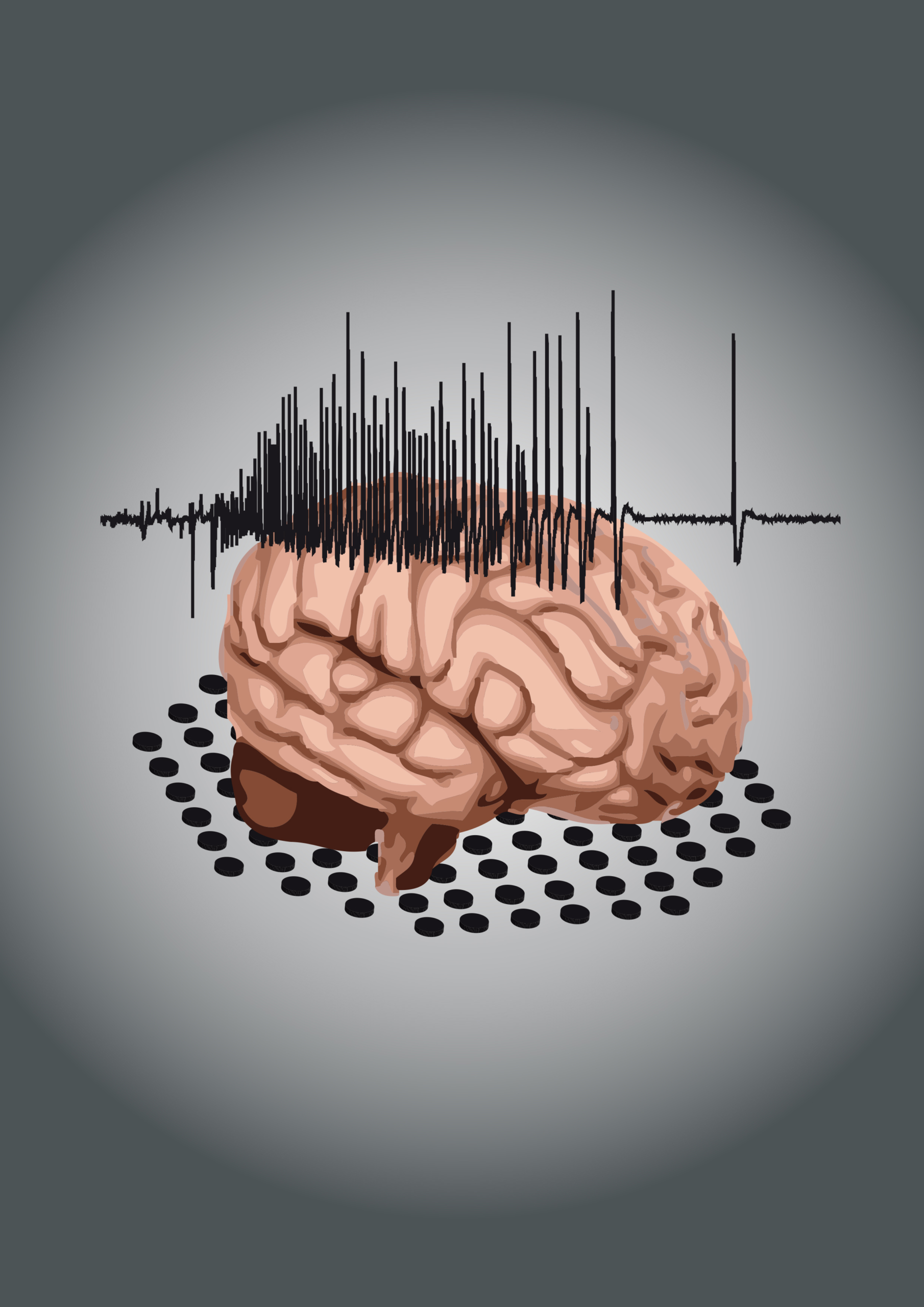 New epilepsy target discovered - European Biotechnology Magazine