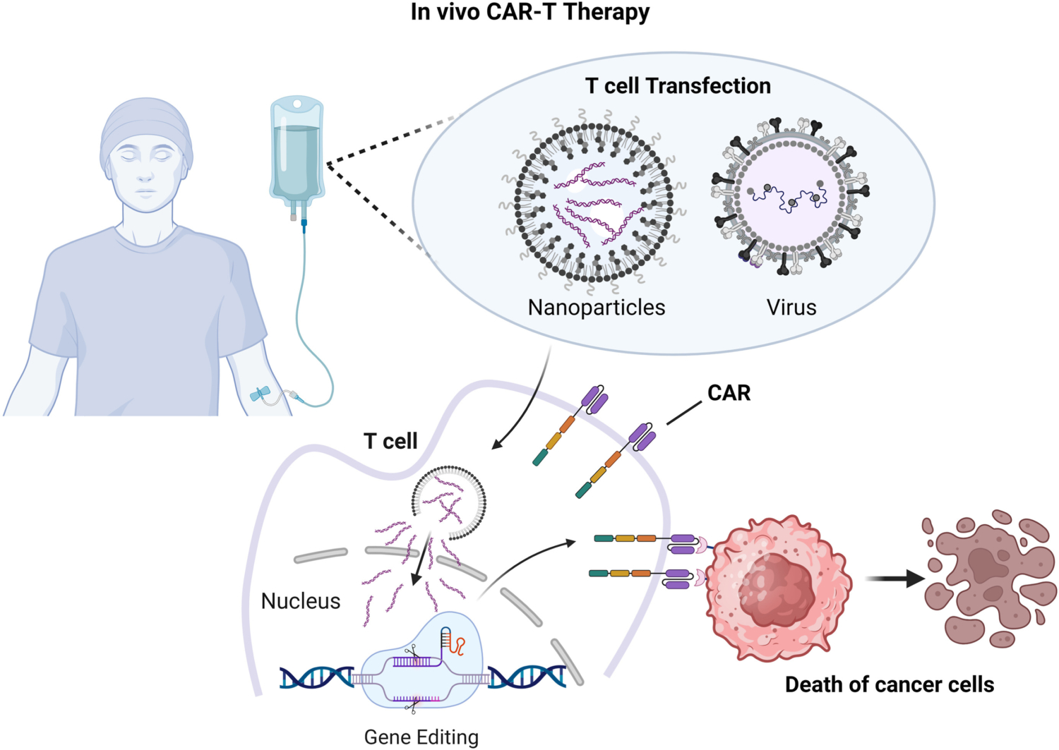 First in vivo CAR gene therapy trial in Europe approved - European Biotechnology Magazine